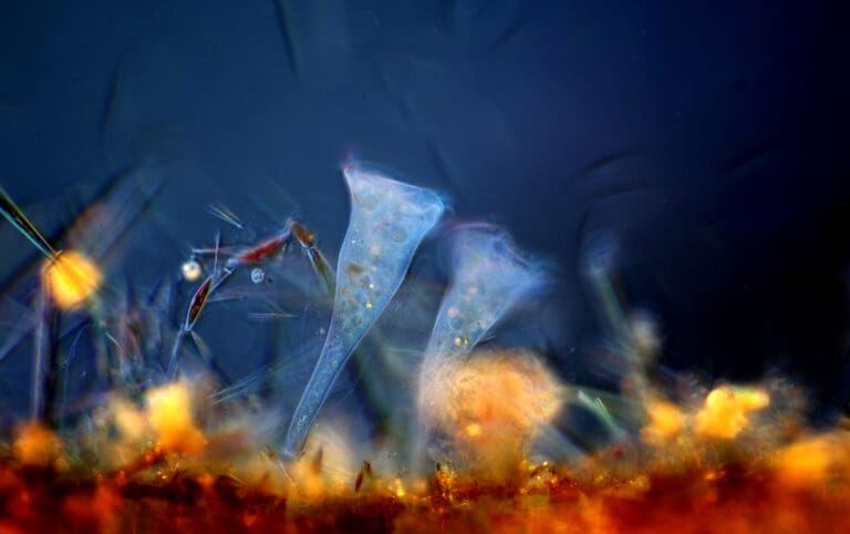 The 10 Largest Single-Cell Organisms in the World - The Quick Report