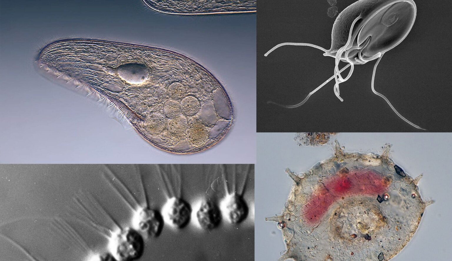 The 10 Largest Single-Cell Organisms in the World - The Quick Report